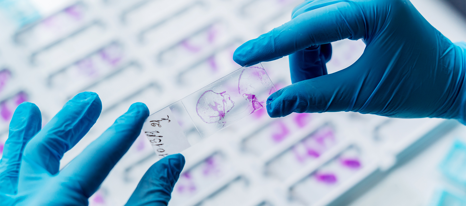 BiopCel – Laboratorio de Biopsia